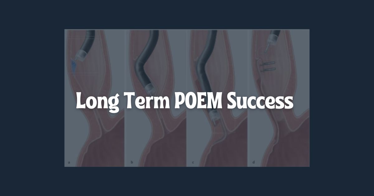 Long Term POEM Success – EndoCollab
