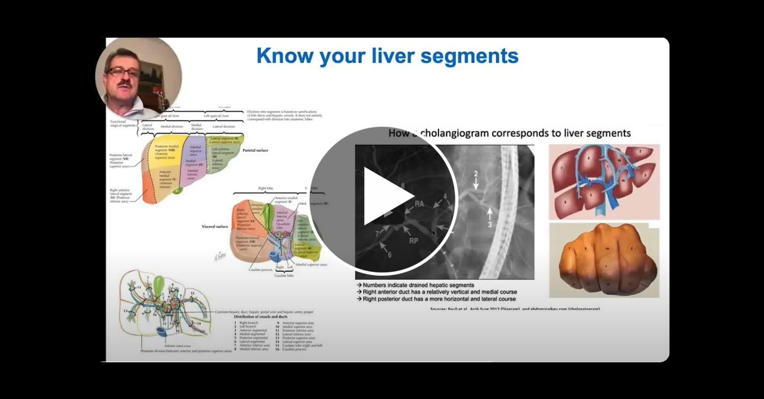 Know Your Liver Segments – EndoCollab
